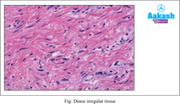 Dense connective Tissue: Components, Types, Cells & Fibres | AESL